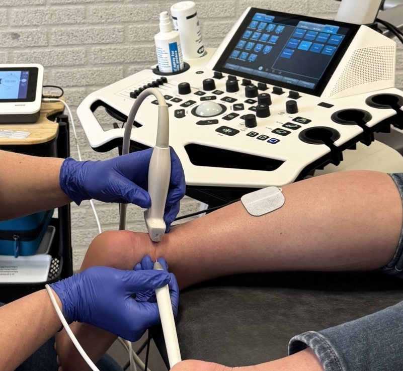 Percutane Electrolyse: Effectieve Behandeling voor Peesblessures ...